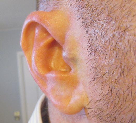 Why This Guy Implanted Headphones In His Ears | Popular Science