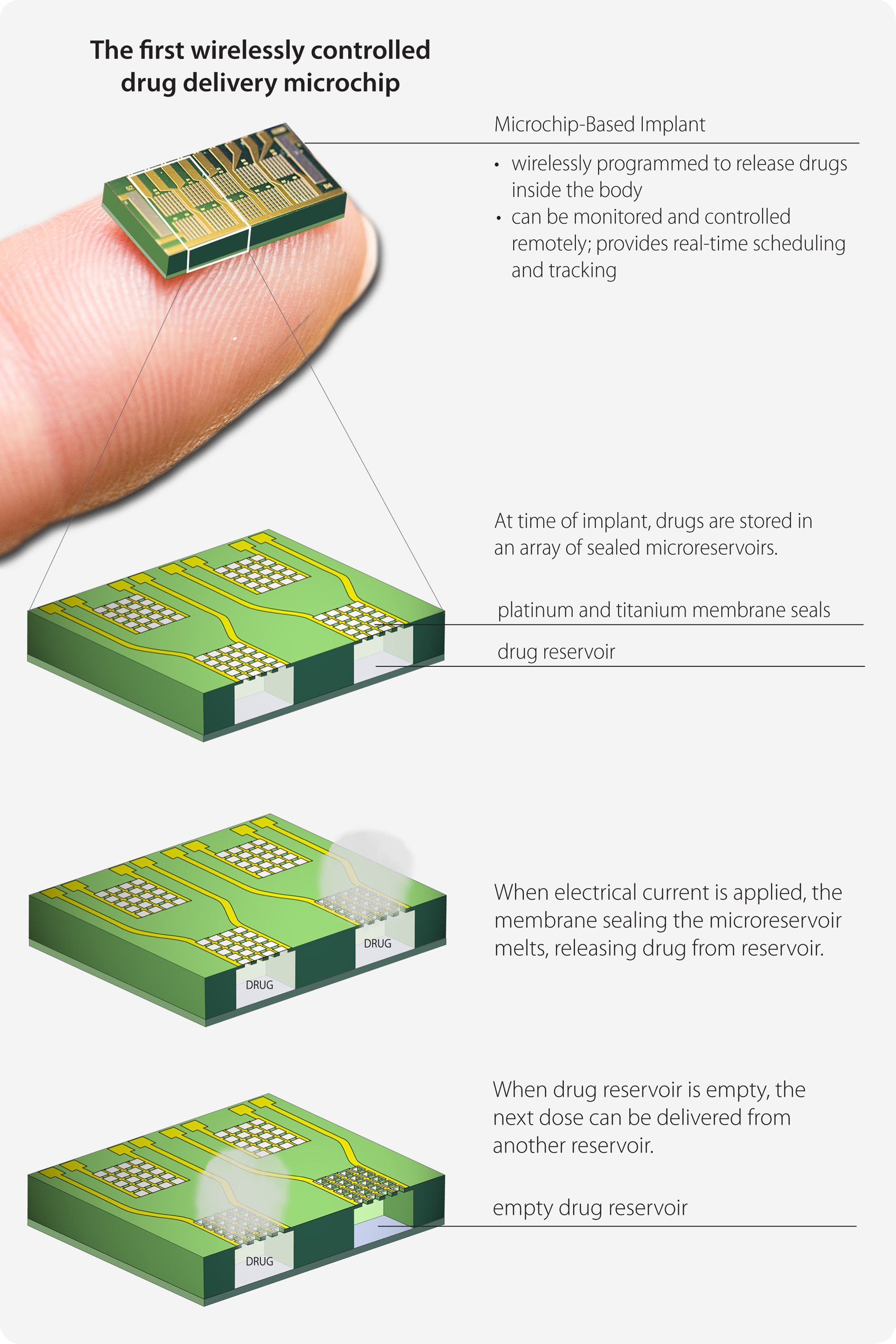 A Wirelessly Controlled Pharmacy Dispenses Drugs From Within Your Abdomen