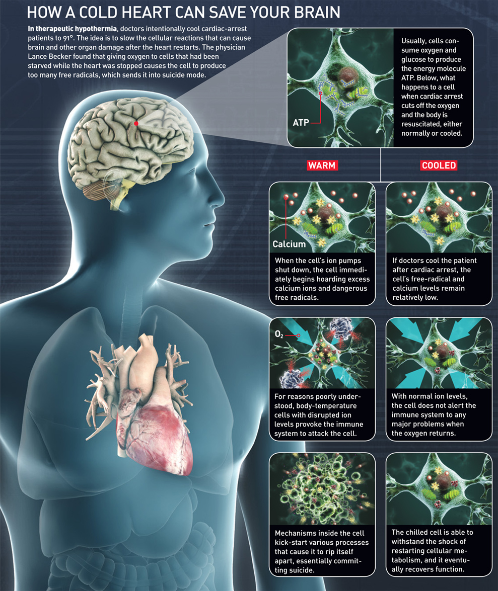 Freezing the heart to save the life | Popular Science