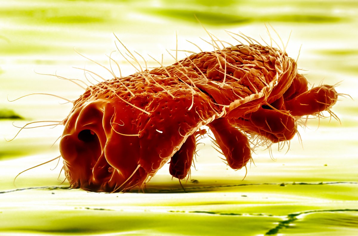 You don’t want these parasites to go extinct