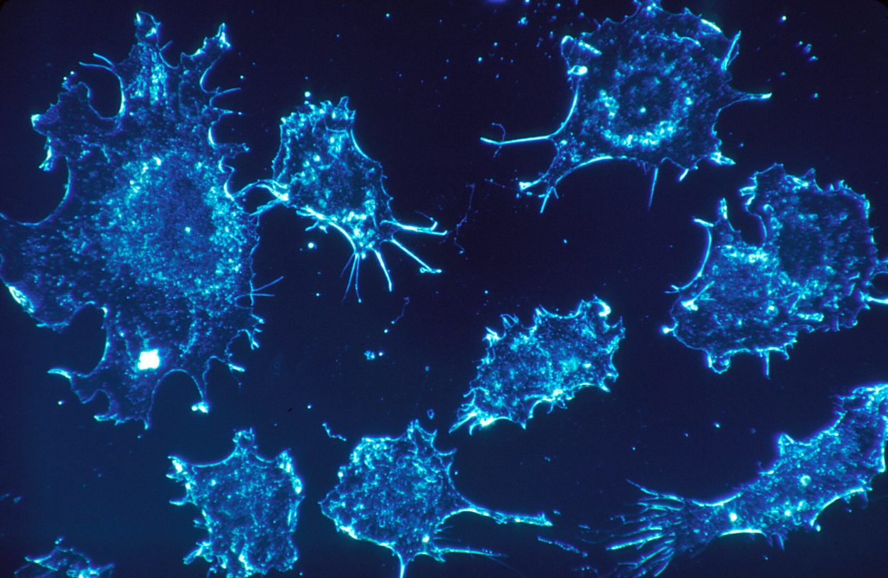How The Meaning Of Cancer Has Changed