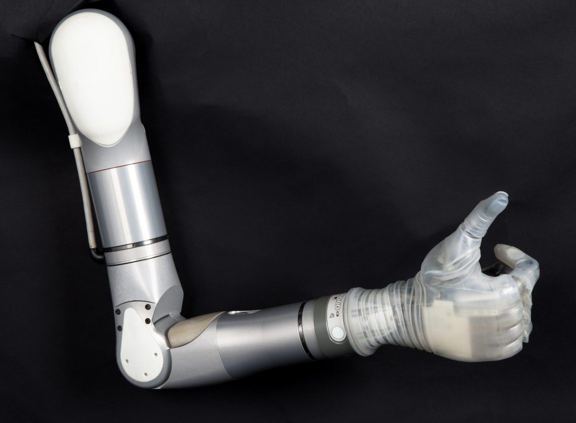 Segway Inventor's Advanced Prosthetic Arm Will Go On Sale This Year
