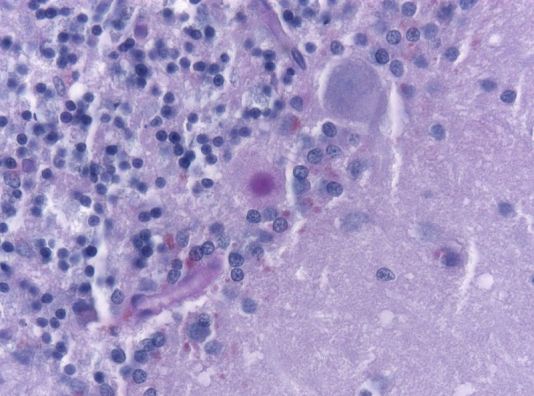 Could Scientists Really Create a Zombie Virus
