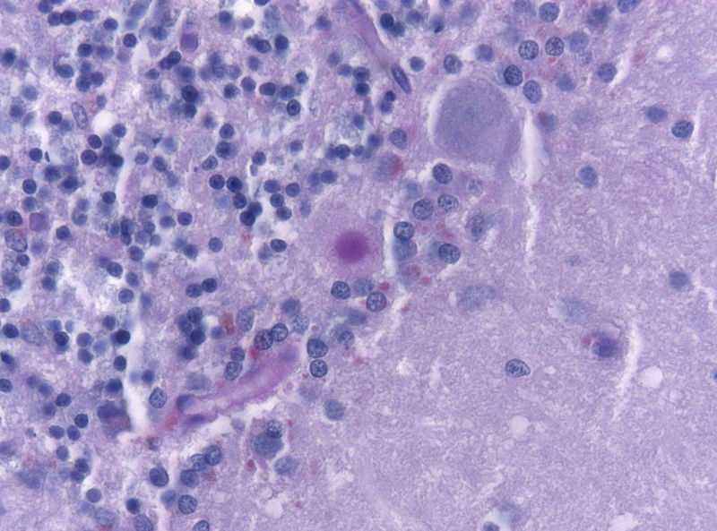 Could Scientists Really Create a Zombie Virus