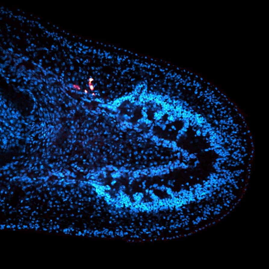 Scientists Create First Cloned Human Embryo