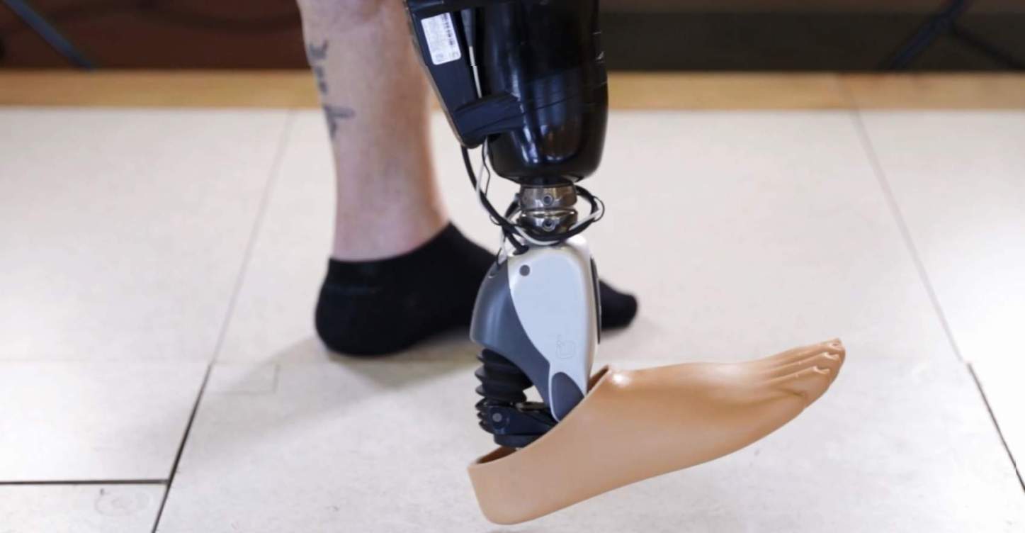 Brain-Controlled Bionic Legs Are Finally Here