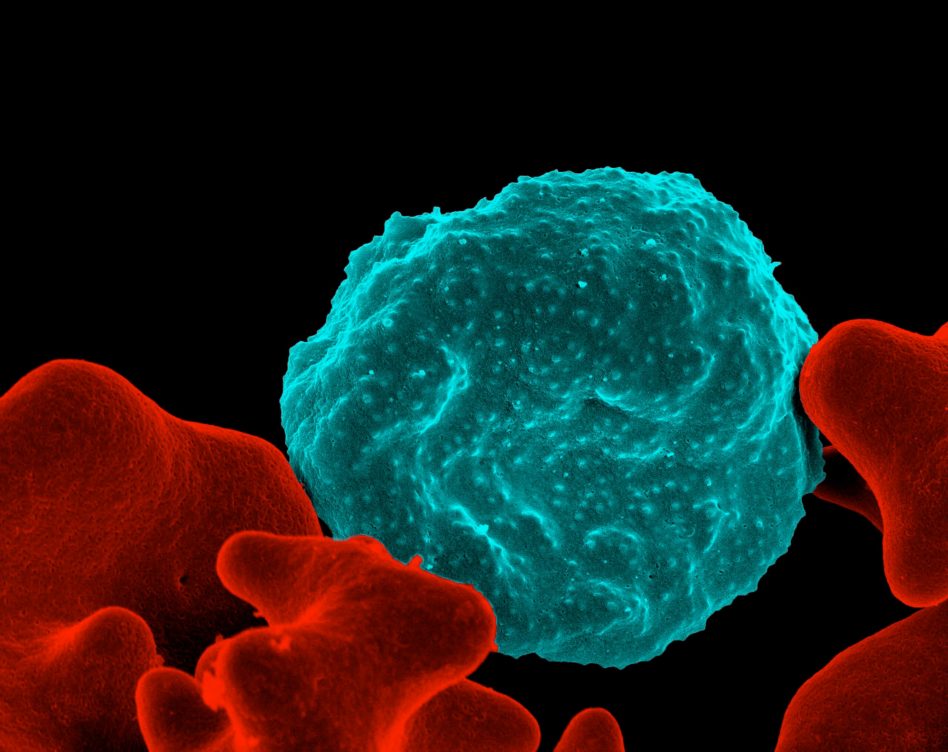 Superbug Outbreak Has Killed Two at UCLA Medical Center