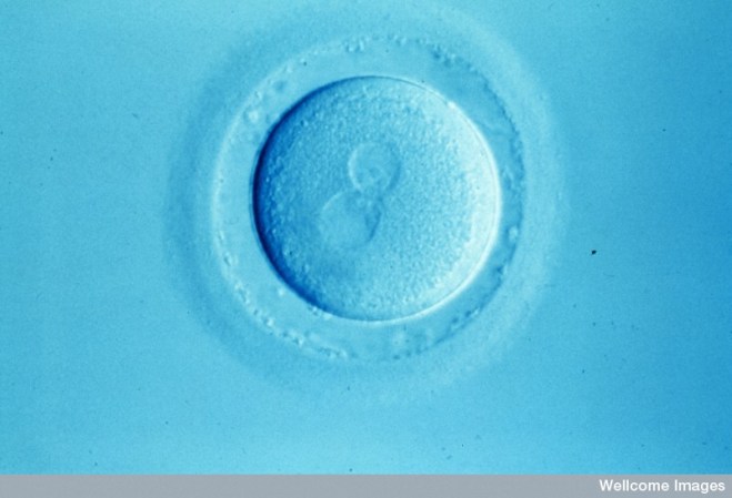 Scientists Create First Cloned Human Embryo