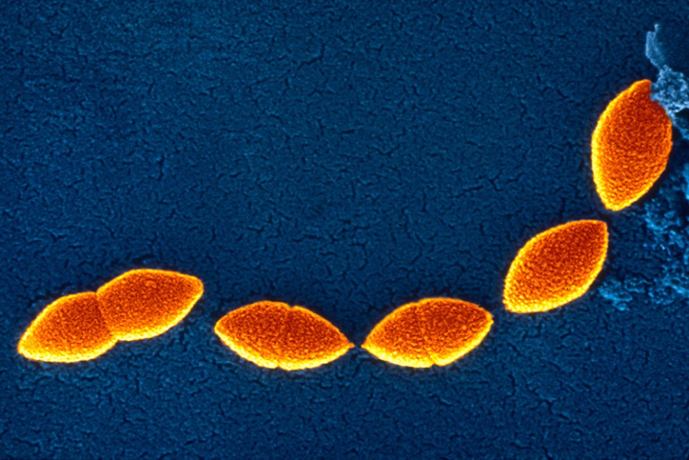 The Double-Edged Sword Of A Nasal Bacterium
