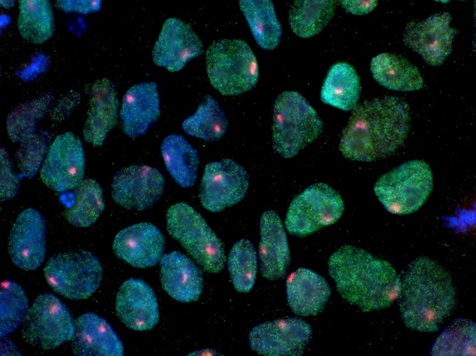 Scientists Grow Full-Sized, Beating Human Hearts From Stem Cells