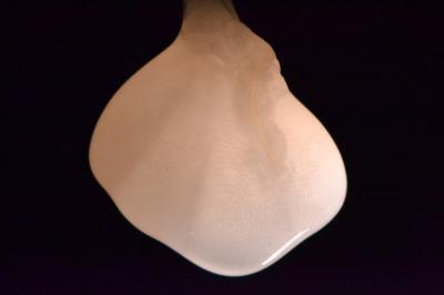 This Bioengineered Rat Kidney Could Pave The Way For On-Demand ...