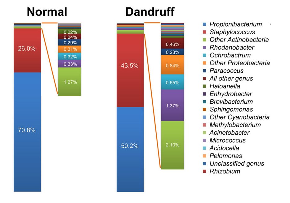 The Bacteria On Your Scalp Could Be Key To Fighting Dandruff