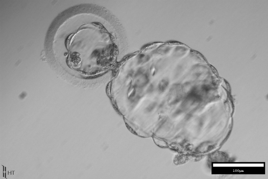 Scientists Create First Cloned Human Embryo