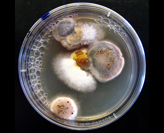 Superbug Outbreak Has Killed Two at UCLA Medical Center