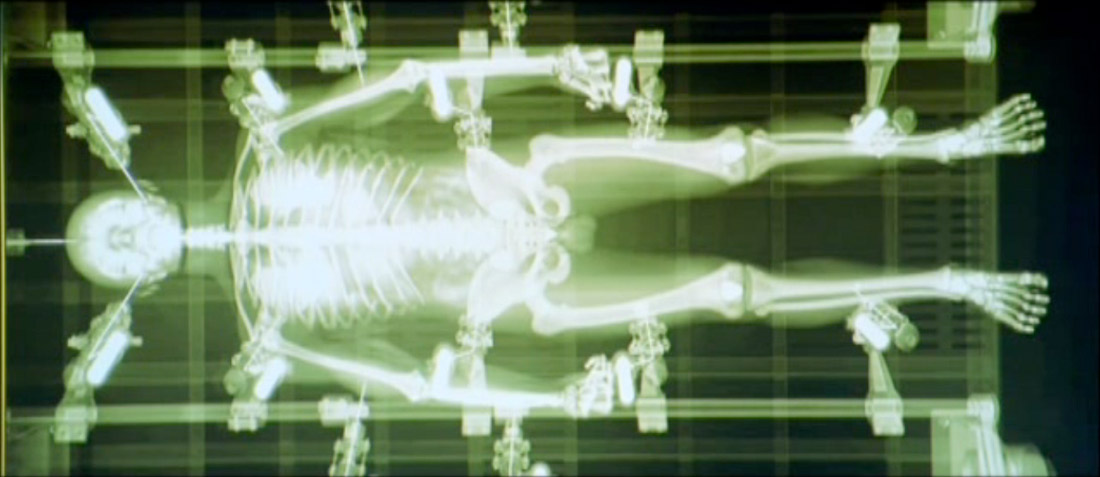 Science Reveals Wolverine's True Weaknesses