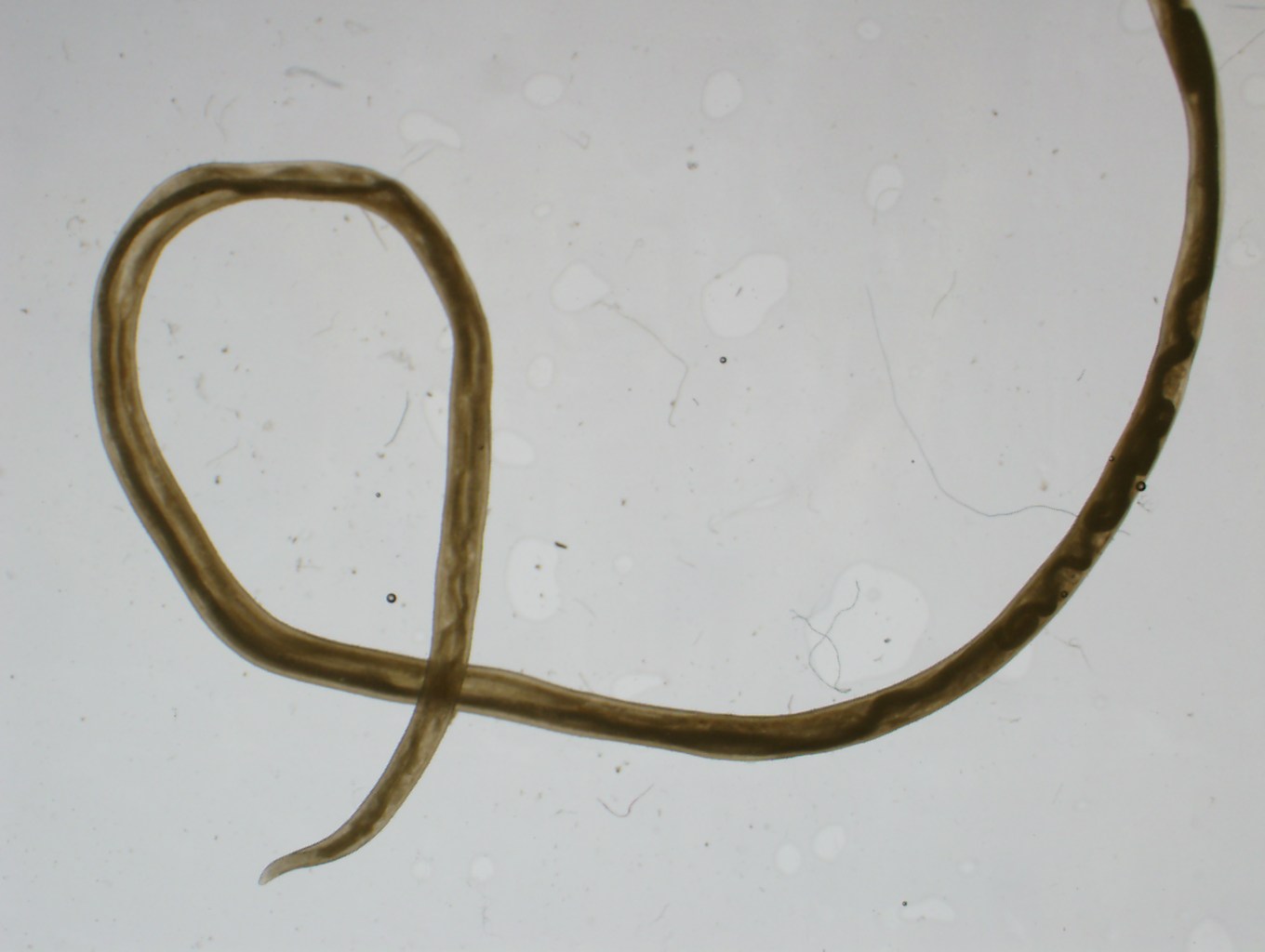 Meet the menagerie of parasites that can live in human eyes