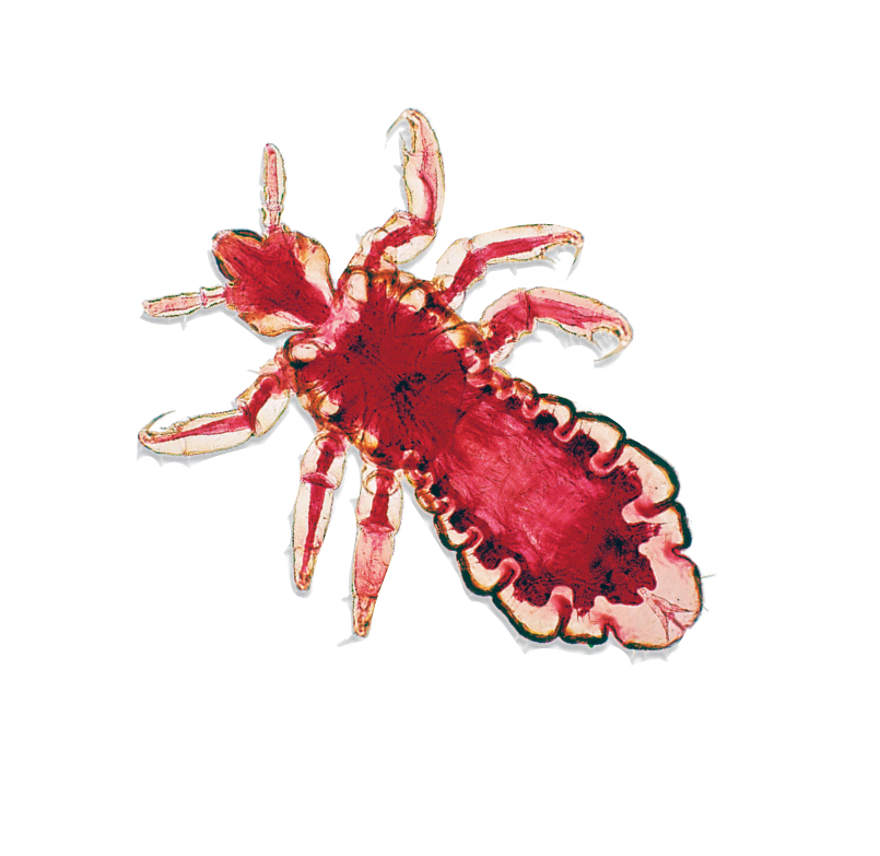 Electric Comb Could Zap Lice From Your Scalp