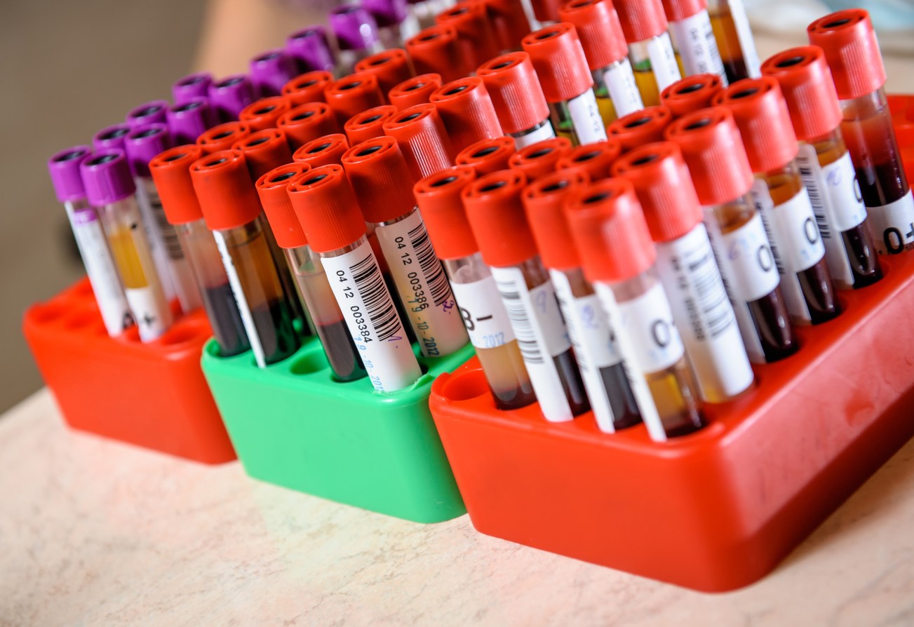 A gut enzyme could turn your Type A blood into precious Type O