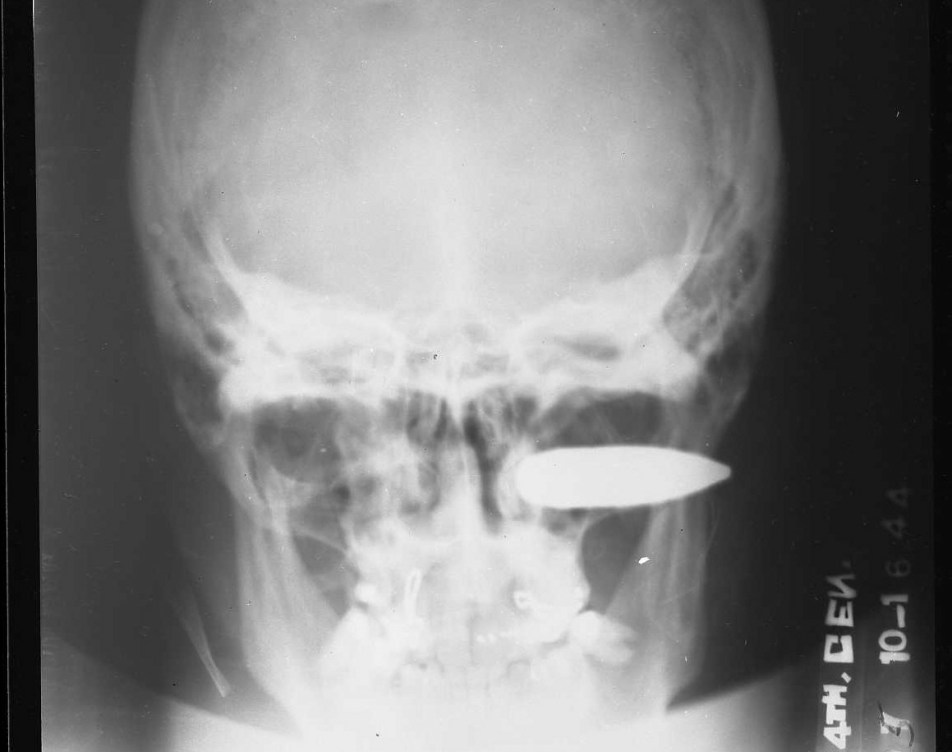 Science Confirms The Obvious: Being Shot In The Face Is Bad