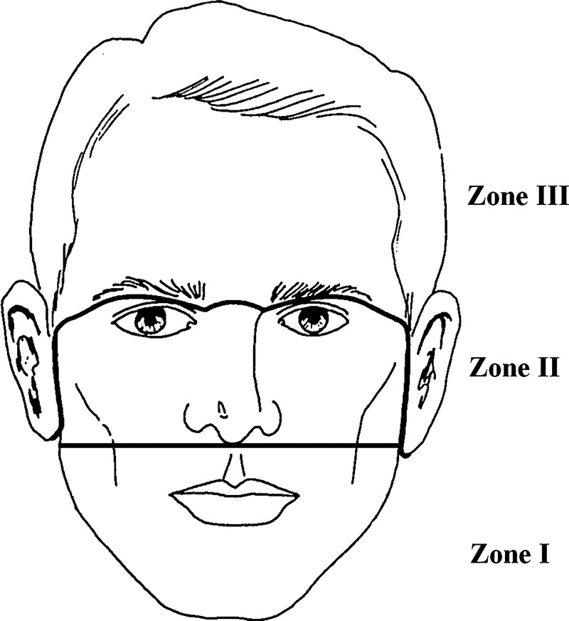 Science Confirms The Obvious: Being Shot In The Face Is Bad