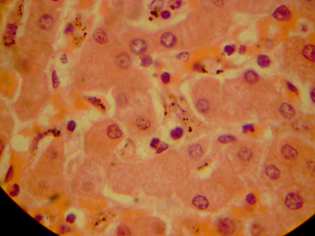 Better Know A Plague: Nobel Prize Edition