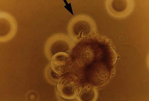 How Mollusk Blood Could Cure Cancer