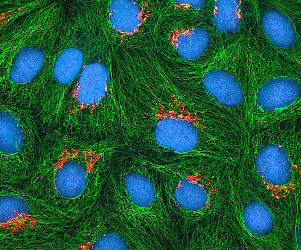 How The Meaning Of Cancer Has Changed