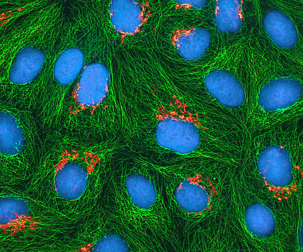 How The Meaning Of Cancer Has Changed