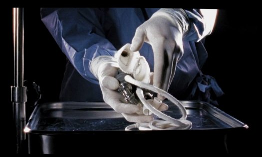 No Pulse: How Doctors Reinvented The Human Heart