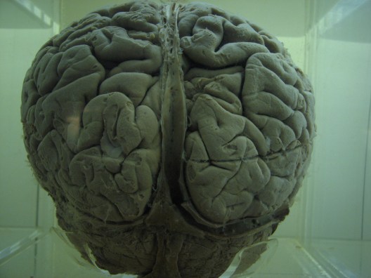 If you grow a brain in a lab, will it have a mind of its own?