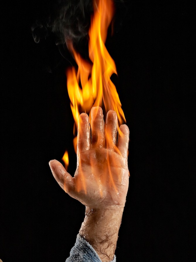 Gray Matter: In Which I Set Myself On Fire