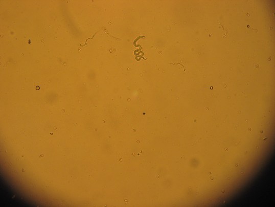 Meet the menagerie of parasites that can live in human eyes