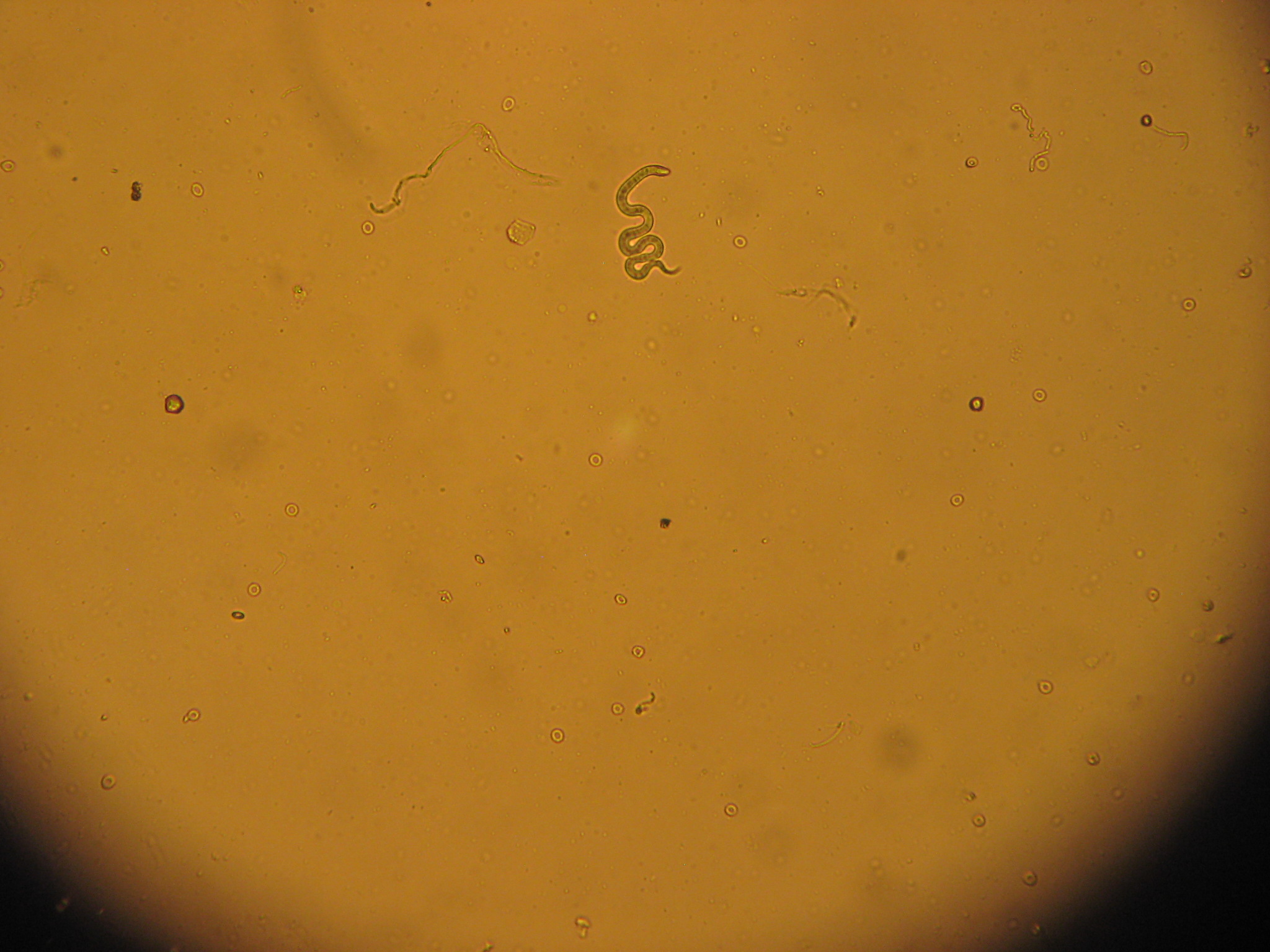 Meet the menagerie of parasites that can live in human eyes