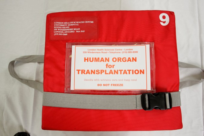 Which Organs Can I Live Without, And How Much Cash Can I Get For Them?