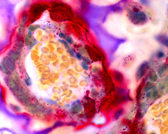 These trippy images reveal the colorful inner lives of bones