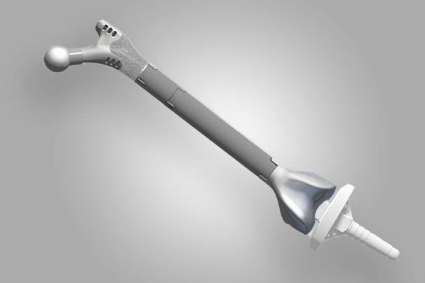 Titanium femurs are real, but so are their risks