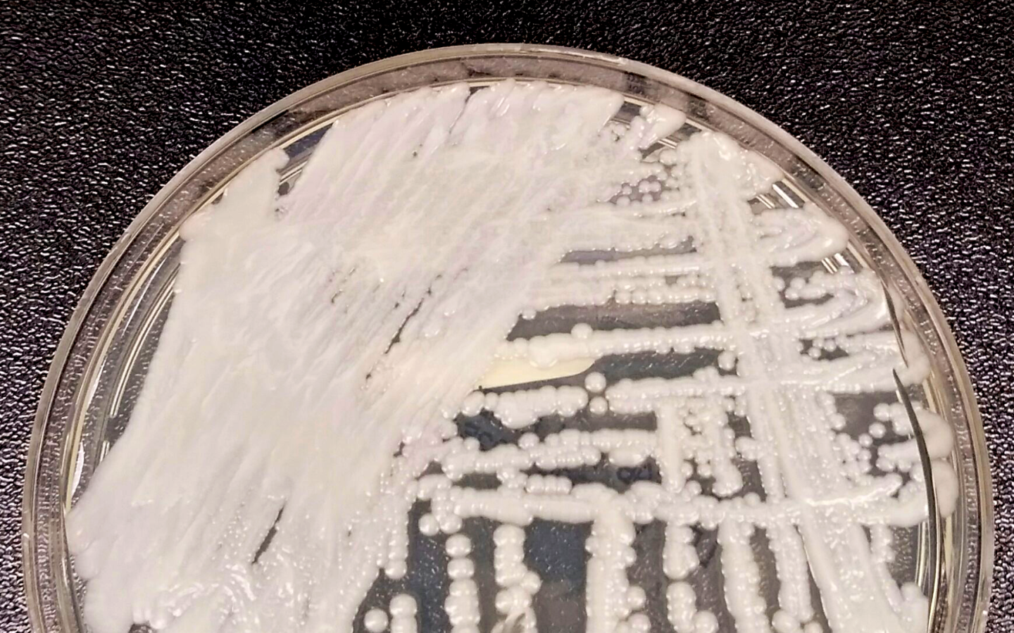 Drug-resistant 'superbug' fungus Candida auris is on the rise in US ...