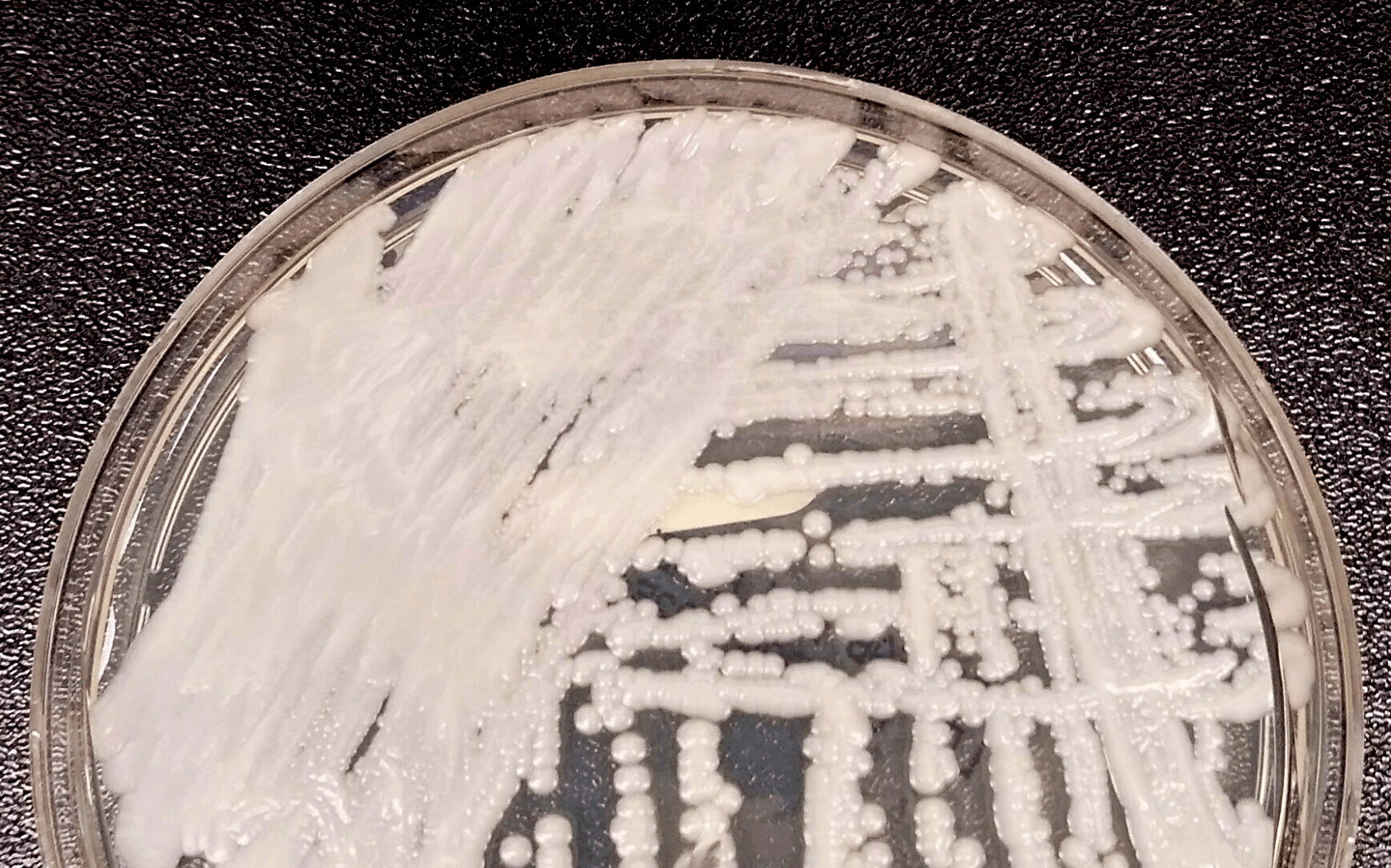 Drug-resistant 'superbug' fungus Candida auris is on the rise in US ...