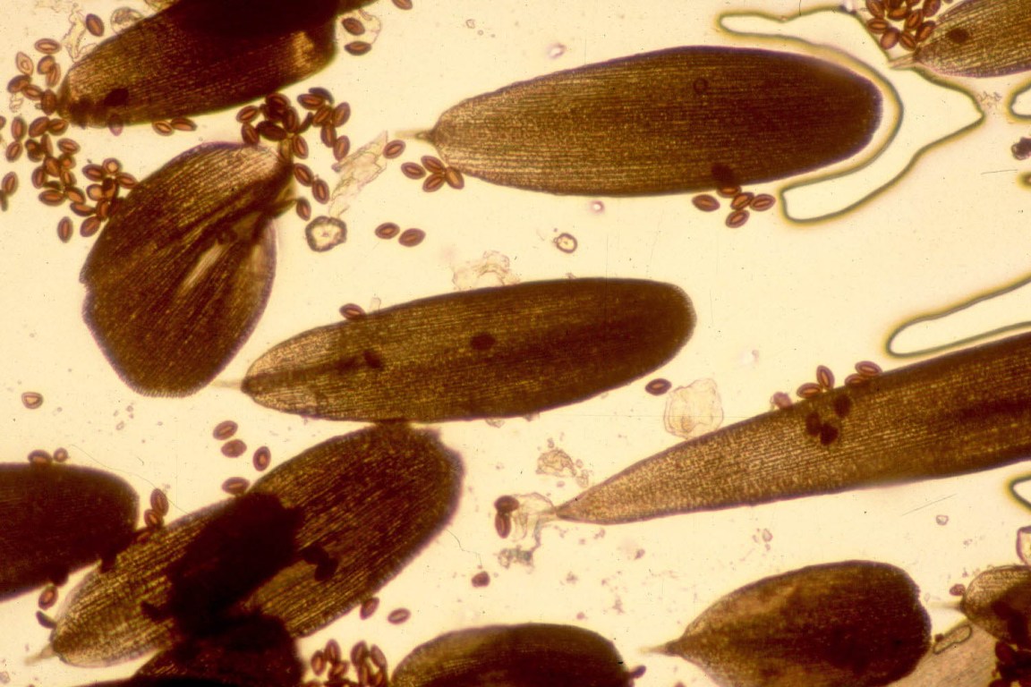 OE parasite affecting hand-raised monarch butterflies | Popular Science