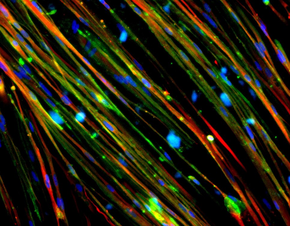 Human Cell Atlas pinpoints rare gene disorder sources | Popular Science