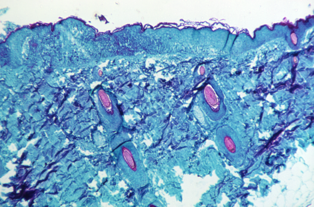 What we know about how monkeypox spreads | Popular Science