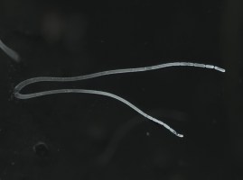 Video of the world's biggest bacteria species | Popular Science