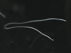 Video of the world's biggest bacteria species | Popular Science