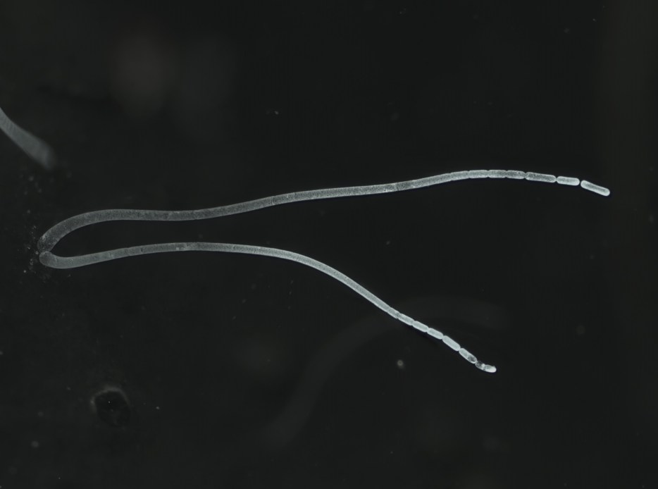 Video of the world's biggest bacteria species | Popular Science