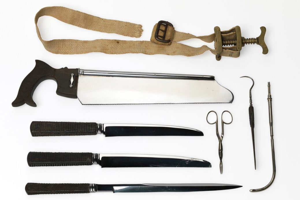 Stories of people surviving amputations through history | Popular Science