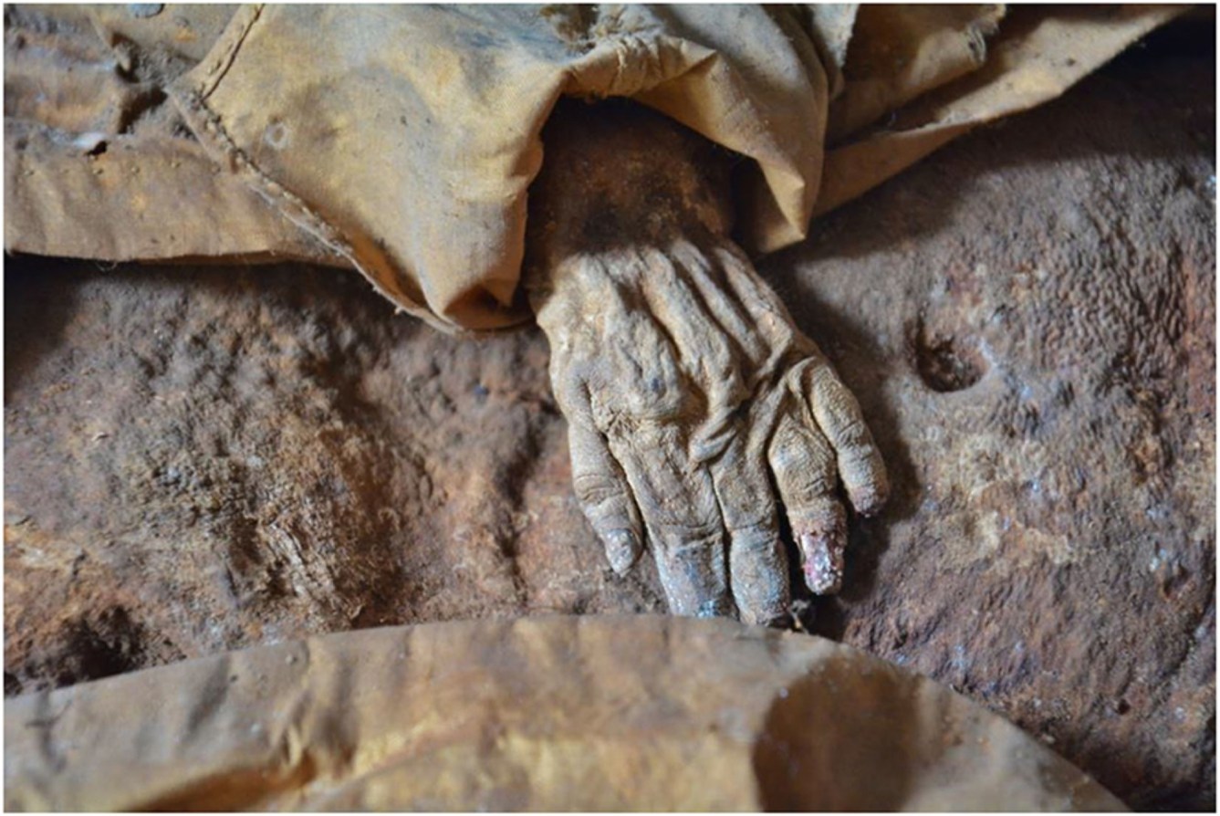 Mummified infant shows how a lack of sunlight can kill | Popular Science