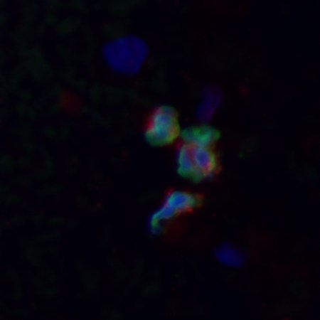 How bear hibernation helps us learn about human health | Popular Science