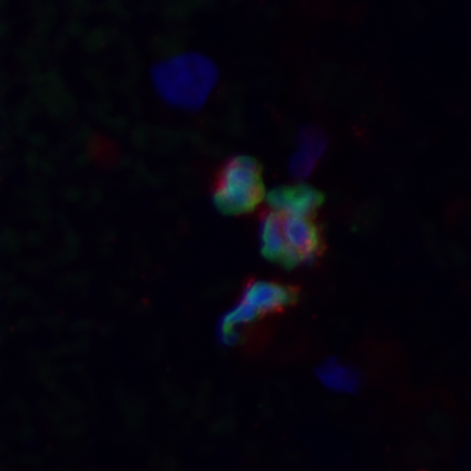 How bear hibernation helps us learn about human health | Popular Science