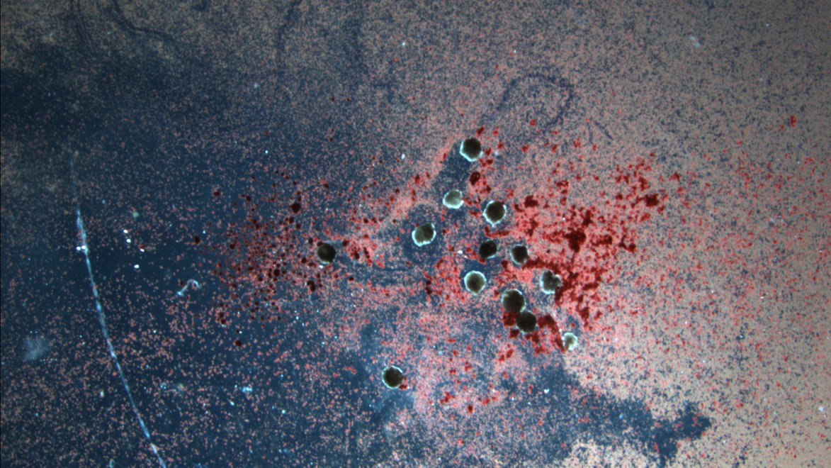 Meet ‘anthrobots,’ tiny bio-machines built from human tracheal cells ...