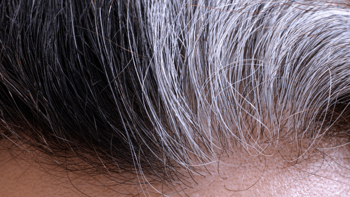 What causes gray hair? The stem cell explanation. | Popular Science